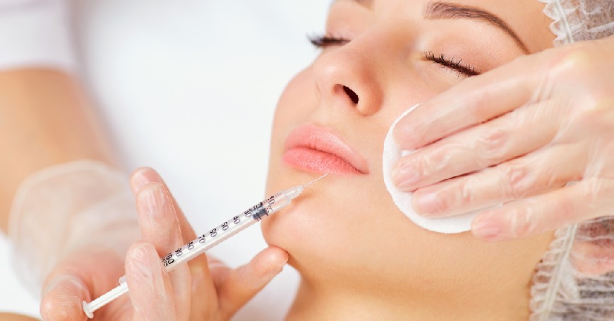 Filler Viso Prima e Dopo